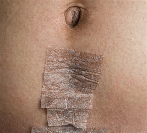 The Top 10 C Section Recovery Must Haves