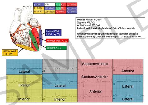 12 Lead Ecg Reference Chart Pdf Cardiovascular Nursing Education Associates