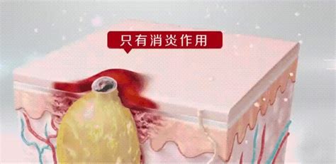 夏季每次运动后就要洗头吗？——青丝恋植发 知乎