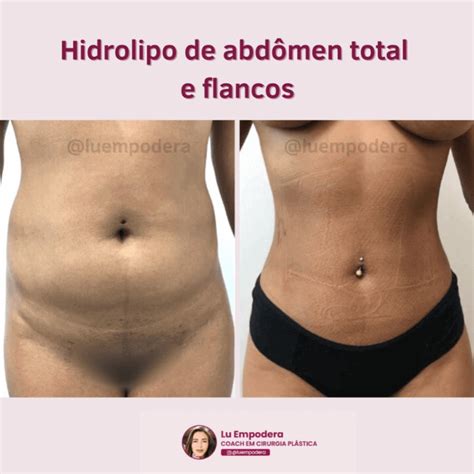 LANDING PAGE HIDROLIPO Lu Empodera