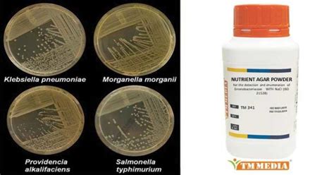 Nutrient Agar Principle Composition Preparation Results Uses