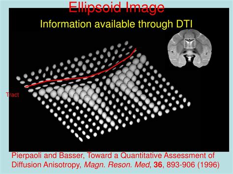 Ppt Dti Basics Water Diffusion Dti Diffusion Tensor Imaging