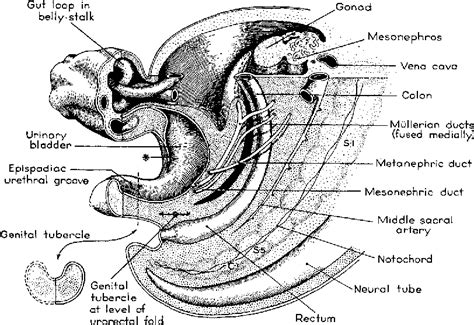 Epispadias Embryology