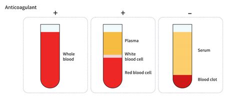 Blood Plasma Separation Blood And Plasma Separation Bps