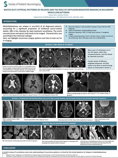 Watch Out Atypical Patterns Of Relapse And The Role Of Diffusion