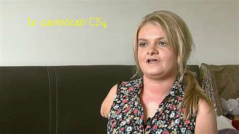 Dae Amputato Xhamster