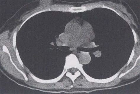 Ct Mri