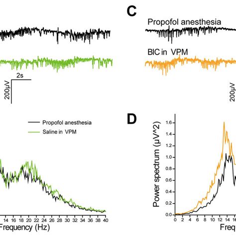 Lfp Recordings In S1 And Power Spectral Analysis A Representative