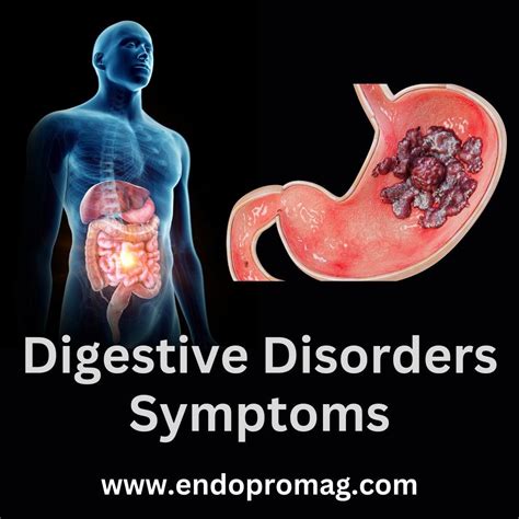 Digestive Disorders