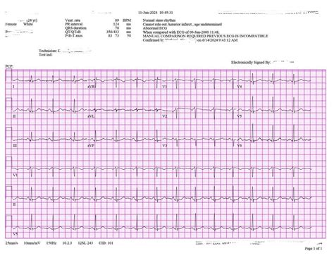 Why Is My Ekg Labeled As Abnormal R Askdocs