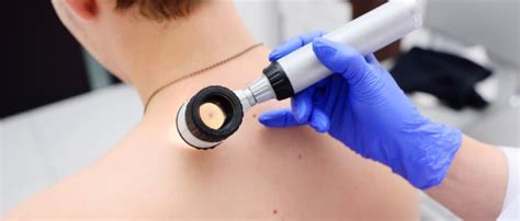 Approaches For Identifying Uncertain Tumor Locations In Skin Cancer Surgery