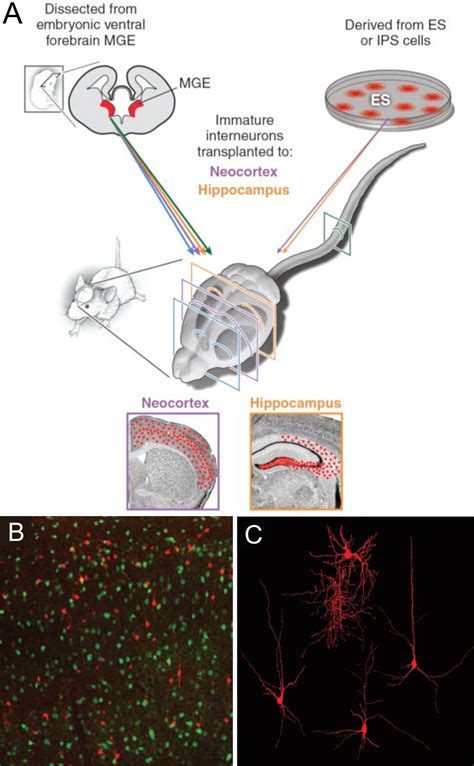 Interneuron Transplantation A Prospective Surgical Therapy For