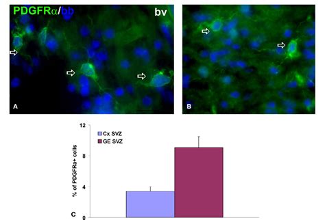 Oligodendrocyte Development Semantic Scholar