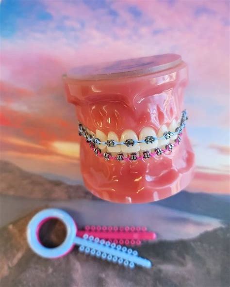 Can You Eat Cotton Candy With Braces Safe Or Risky 1