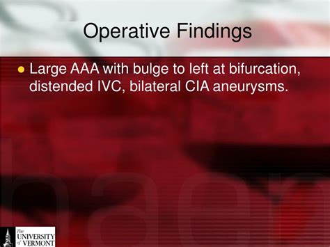 Ppt Bilateral Leg Swelling Powerpoint Presentation Free Download