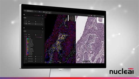 Unlocking The Power Of Multiplex Analysis Nucleai