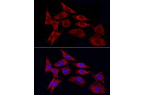 Anti Tgf Beta 1 Antibody A92358