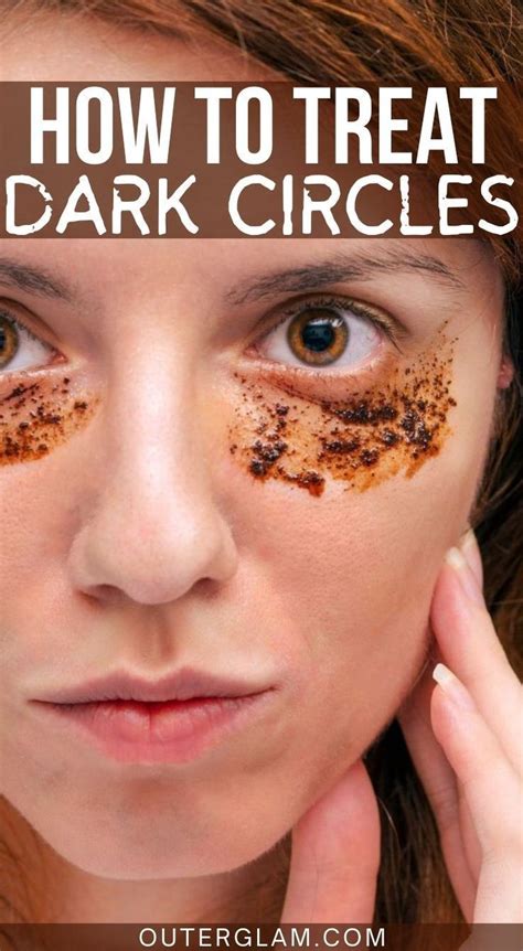 How To Treat Dark Circles Dark Circles Dark Eye Circles Dark