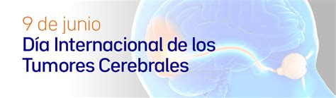 8 De Junio Día Internacional De Los Tumores Cerebrales Werfen En España