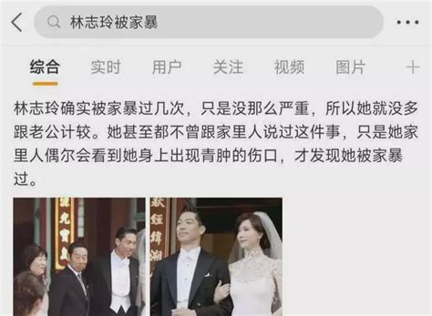 林志玲被家暴？疑似被黑澤良平打出來了
