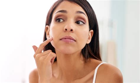 Skin Purging Vs Breakout How To Spot The Difference Tips Flipboard