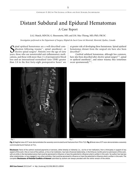 Pdf Distant Subdural And Epidural Hematomas A Case Report