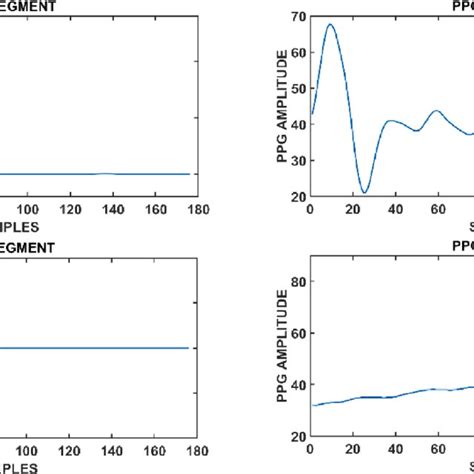 Examples Of Bad Ppg Segments That Were Screened And Discarded During Download Scientific