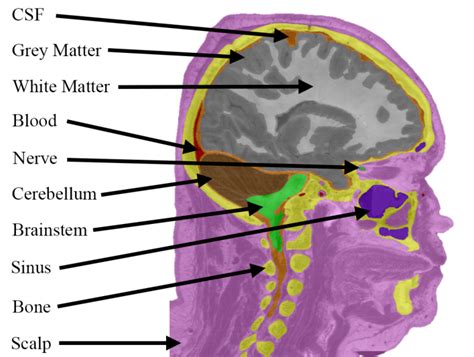 sagittal slice showing some segmented tissues in the model download