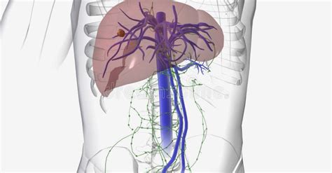 Liver Cancer Is Characterized By Tumor Growth That Begins In The Liver