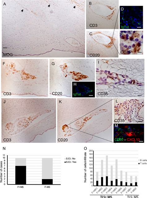 Neuropathological Characterization Of Subependymal Perivascular
