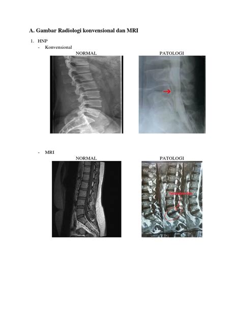 Gambar Radiologi Konvensional Dan Mri Pdf