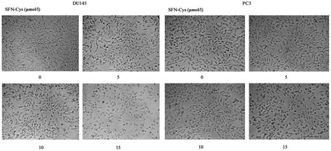 Sulforaphane Cysteine Suppresses Invasion Via Downregulation Of