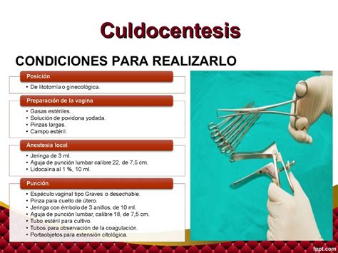 Culdocentesis Usa News Collections