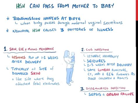 Herpes Simplex Infectionhsv Pptx