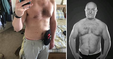 Men With Ibd Answer Questions On What Its Like To Live With A Stoma Bag Metro News