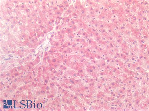 IHC Plus CTSK Cathepsin K Polyclonal Antibody Rabbit IHC LSBio