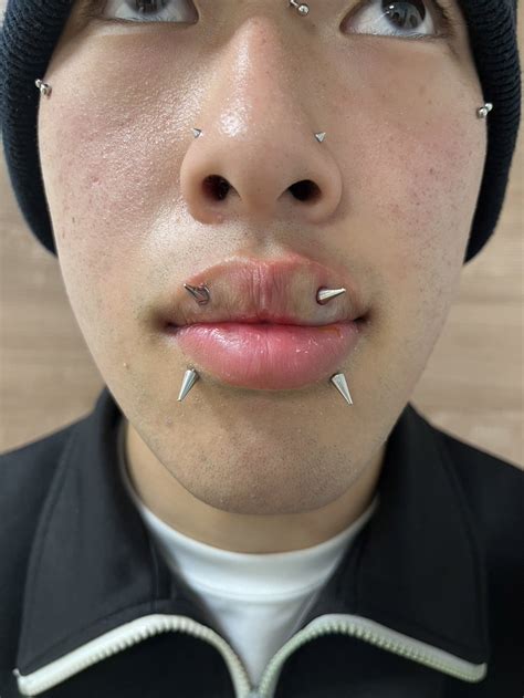 ピアスモニター様ご紹介 アネシス美容クリニックのブログ