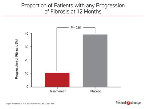 Hiv Patients With Nafld Are At High Risk Of Progressive Liver Fibrosis