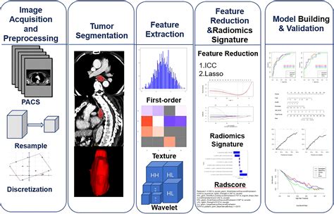 A Radiomics Nomogram Based On Contrast Enhanced CT For Preoperative