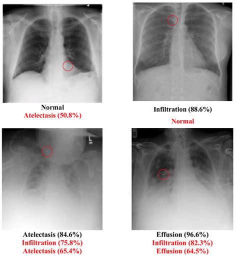 Adversarial Attacks On Medical Image Classification