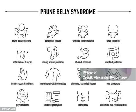 Prune Belly Syndrome Symptoms Diagnostic And Treatment Vector Icon Set