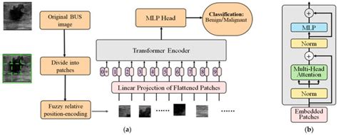 A Novel Fuzzy Relative Position Coding Transformer For Breast Cancer Diagnosis Using Ultrasonography