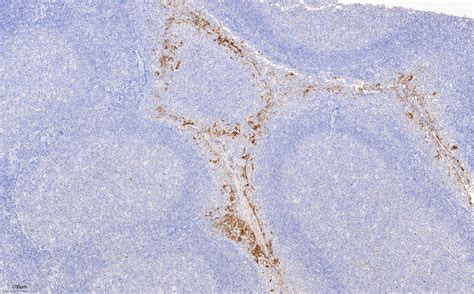 Cdkn2a P16 Ink4a Antibody 60626 1 Ig Proteintech