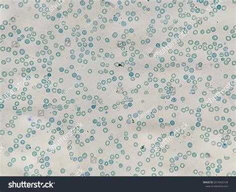 Reticulocyte Count Under Microscope 100x Methylene Foto Stock 2019426149 Shutterstock