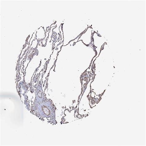 Tissue Expression Of Acta2 Staining In Lung The Human Protein Atlas