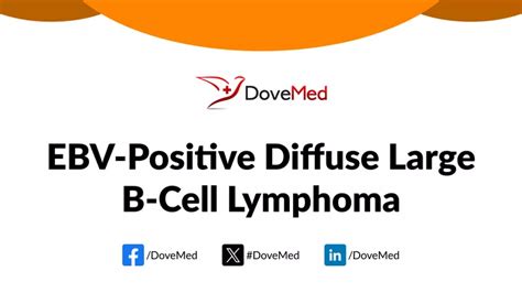 Ebv Positive Diffuse Large B Cell Lymphoma Dovemed