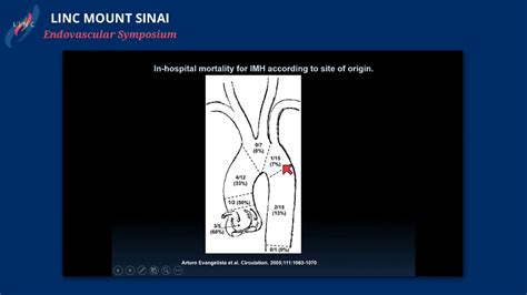 Penetrating Aortic Ulcerations What Are They And When Should They Be