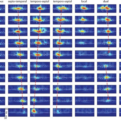 Spatial Extent And Propagation Of Ripple Events Examples Of Single Download Scientific Diagram