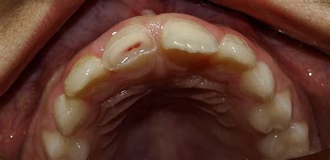 Clinica Omega Traumatismo Dental