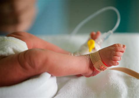 25 Facts About Macules Hereditary Congenital Hypopigmented And